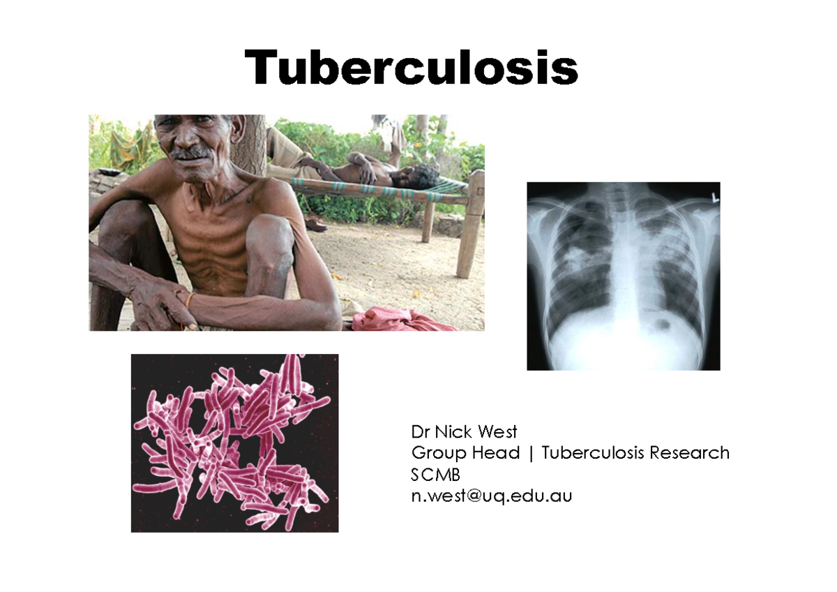 TB Lecture Slides - Tuberculosis Dr Nick West Group Head | Tuberculosis ...