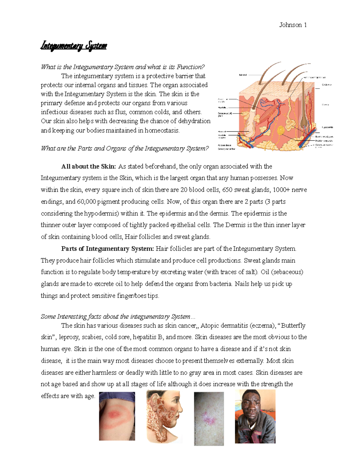 Biology - Integumentary System-3 - Johnson 1 Integumentary System What ...
