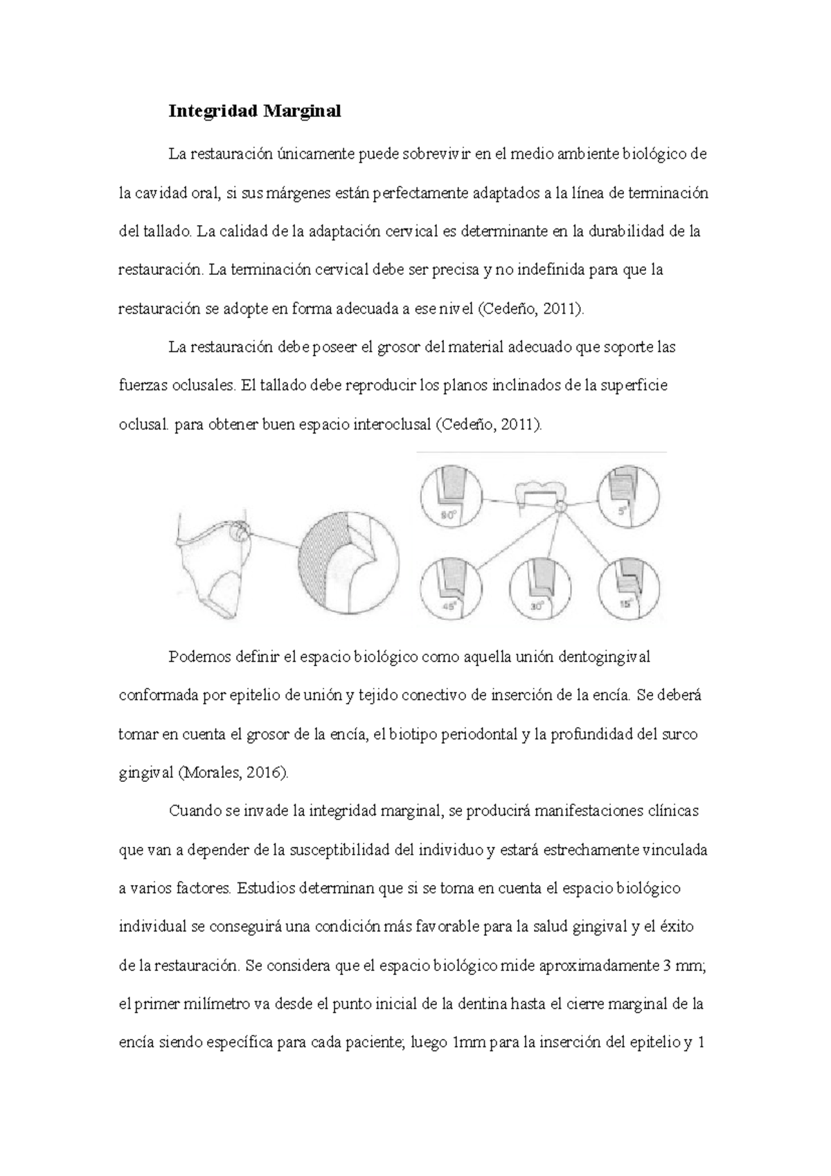 Integridad Marginal protesis - Integridad Marginal La restauración ...