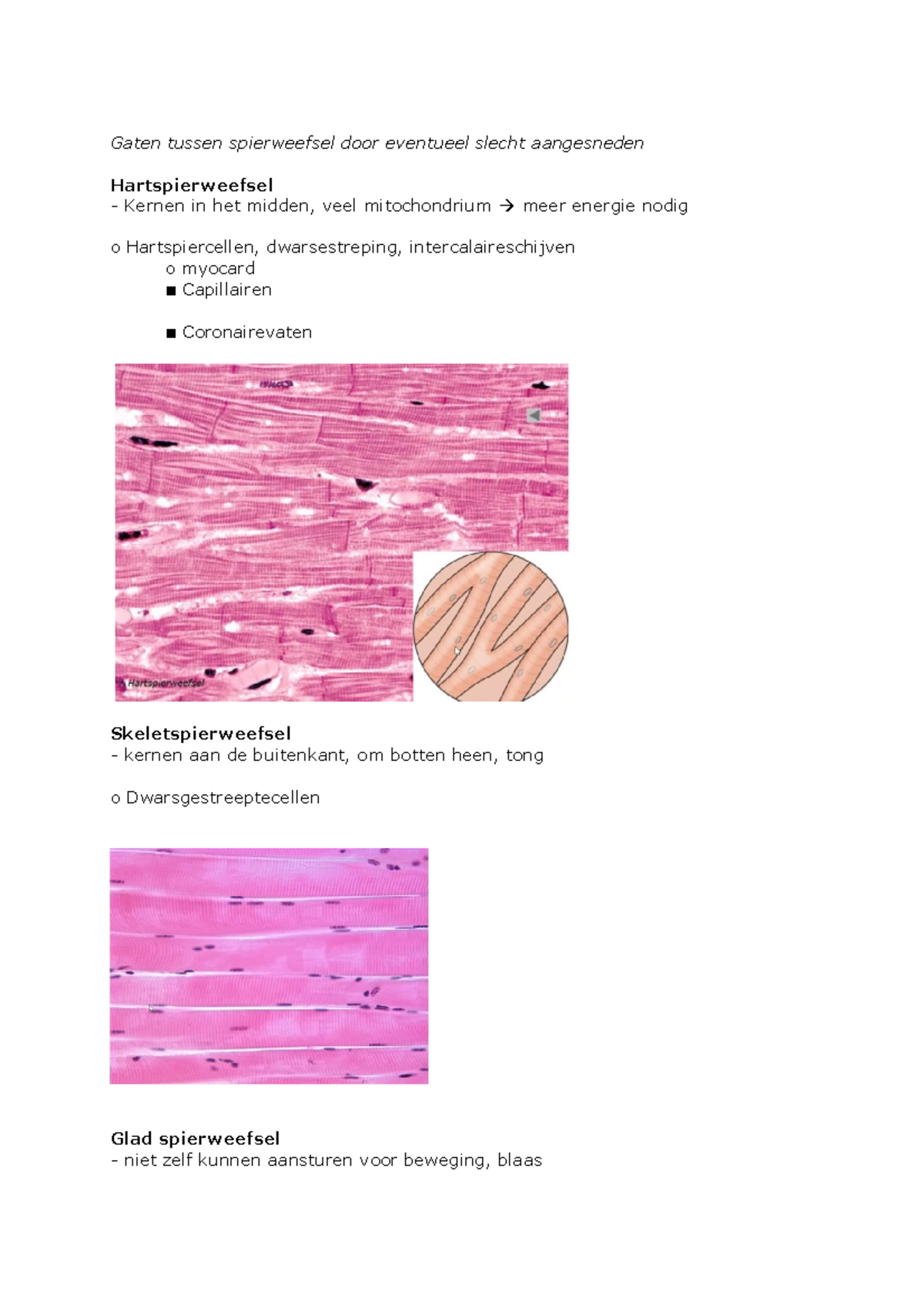 BLT pt 05 spierweefsel - Gaten tussen spierweefsel door eventueel ...