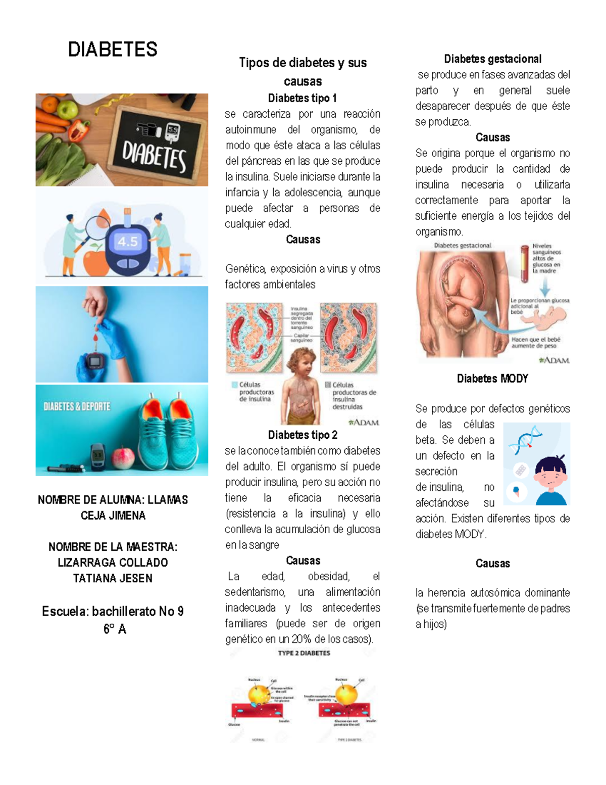 Triptico diabtes - Guyton e Hall - Fisiologia medica 13 ed. - DIABETES ...