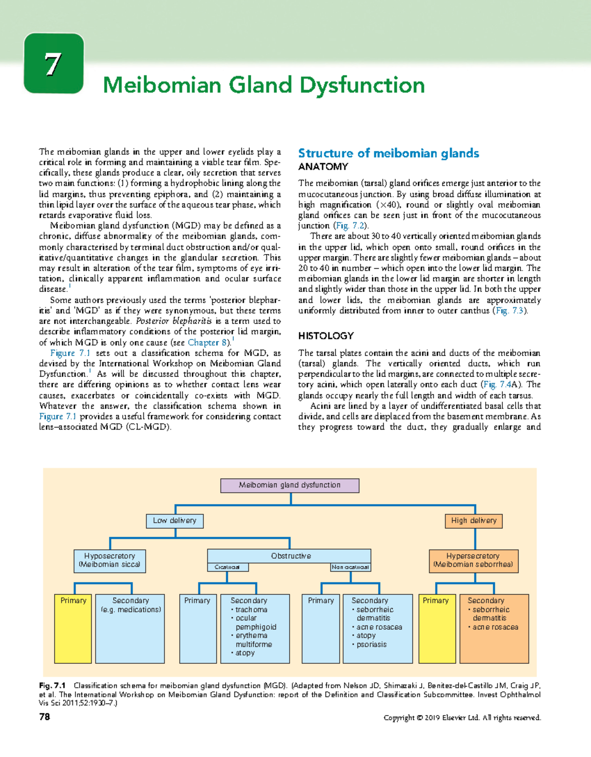 Meibomian Gland Dysfunction Contact Lens Complications - 77 Meibomian ...