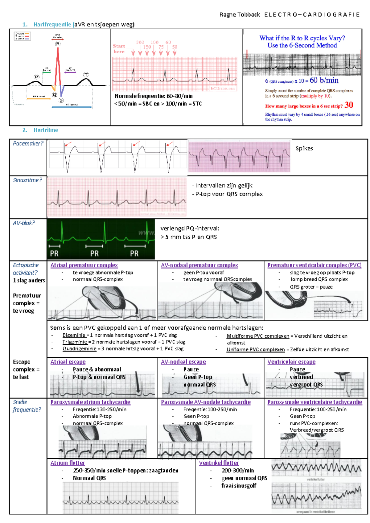 Spiekbrief ECG . - Ragne Tobback E L E C T R O – C A R D I O G R A F I ...