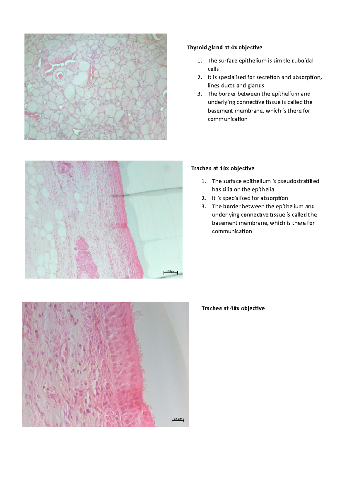Histology prac - Trachea at 10x objective The surface epithelium is ...