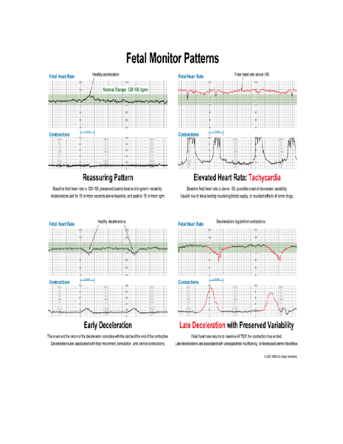 Pictures of basic fetal monitor patterns - Nur 265 - Studocu