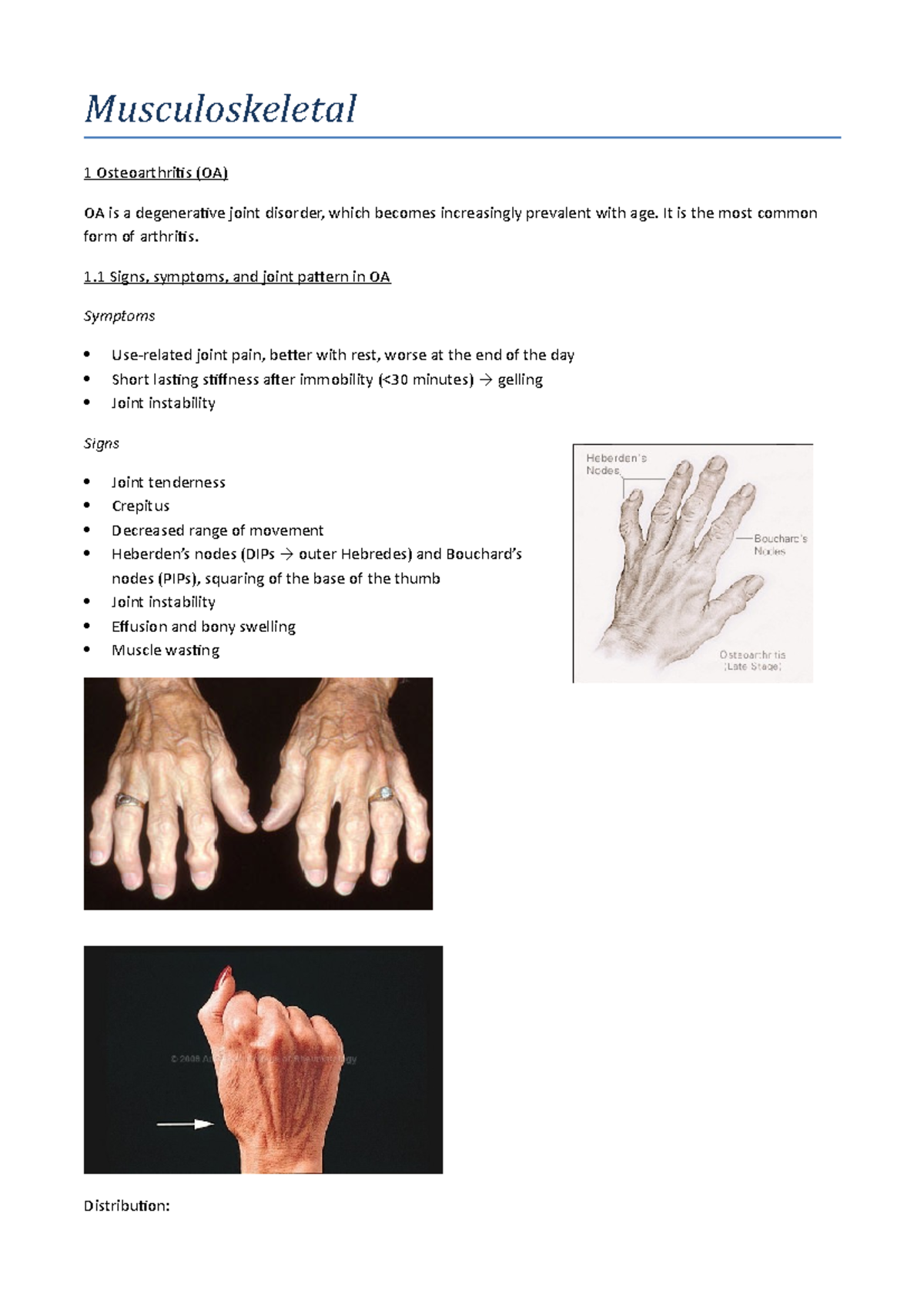 MSK medicine finals notes - Musculoskeletal 1 Osteoarthritis (OA) OA is ...