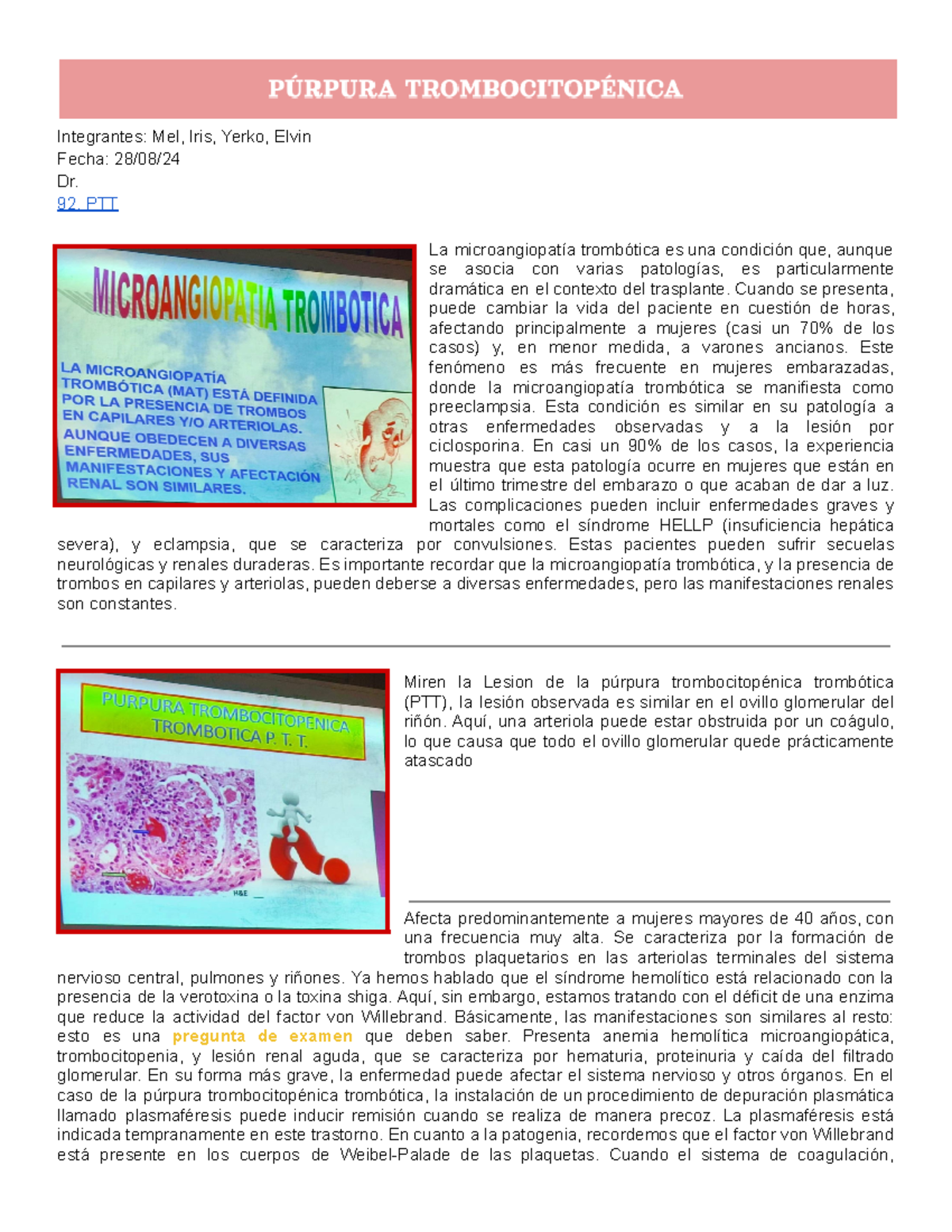 Púrupura Trombocitopénica Tombótica - Integrantes: Mel, Iris, Yerko ...