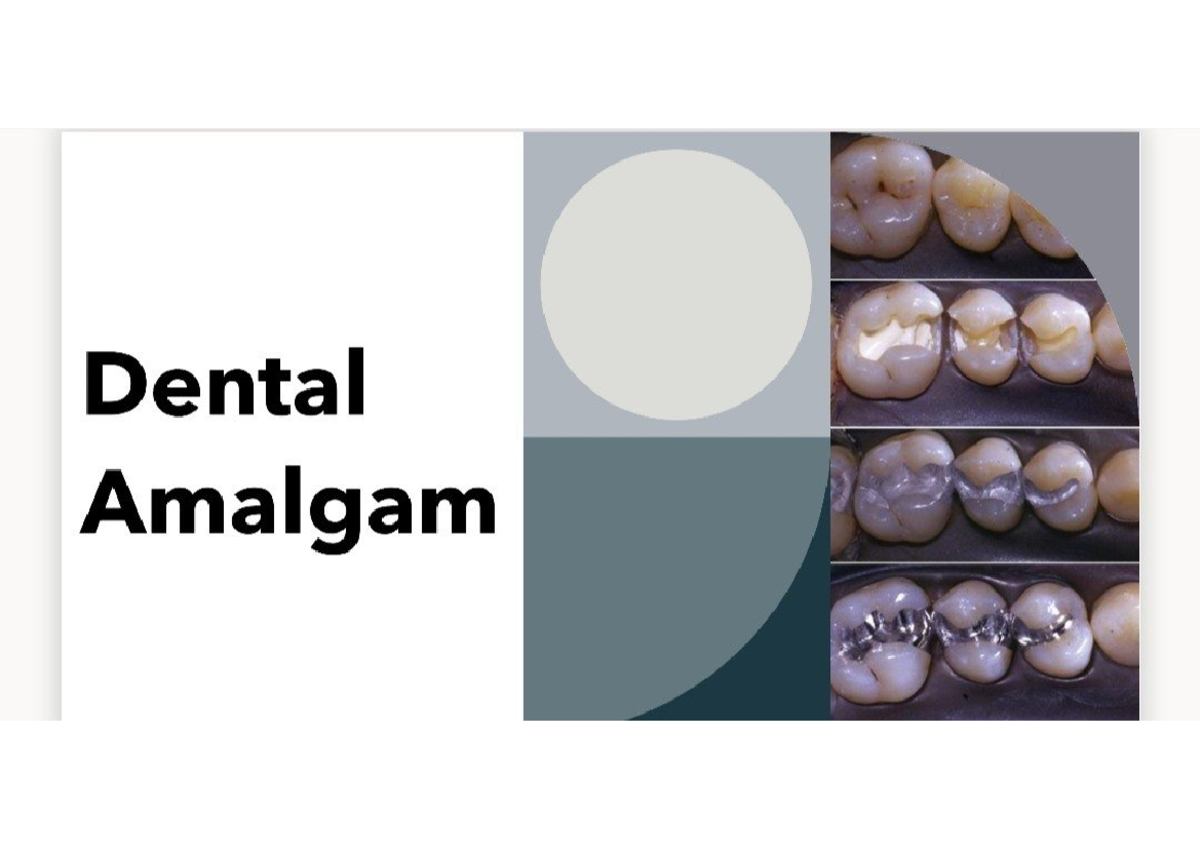 2 - dental anatomy lecture - Dental Amalgam Dental Amalgam Direct ...