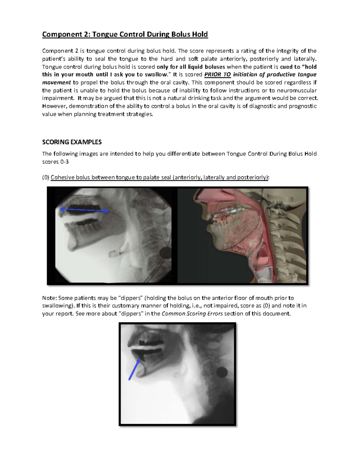 2-Tongue Control Bolus Hold - Component 2: Tongue Control During Bolus ...