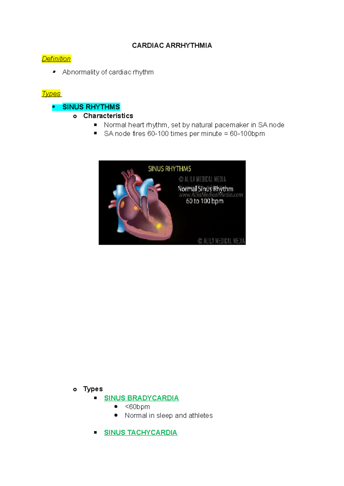 Cardiac Arrhythmias - Lecture notes 14 - CARDIAC ARRHYTHMIA Definition ...