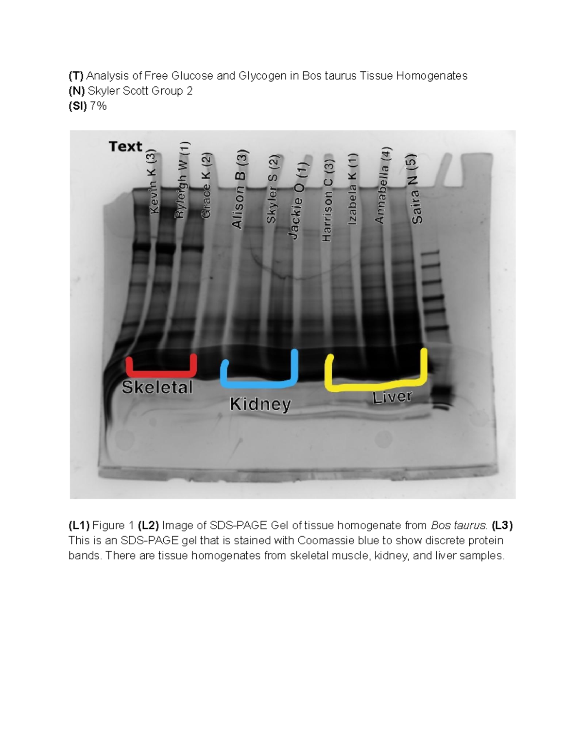 BIOL 113 Lab Report 3 - (T) Analysis of Free Glucose and Glycogen in ...