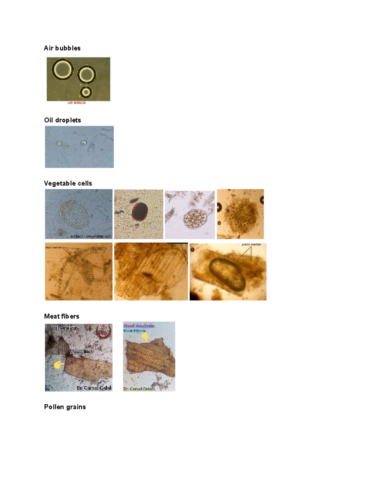 Fecal artifacts - Medical Laboratory Science - Air bubbles Oil droplets ...