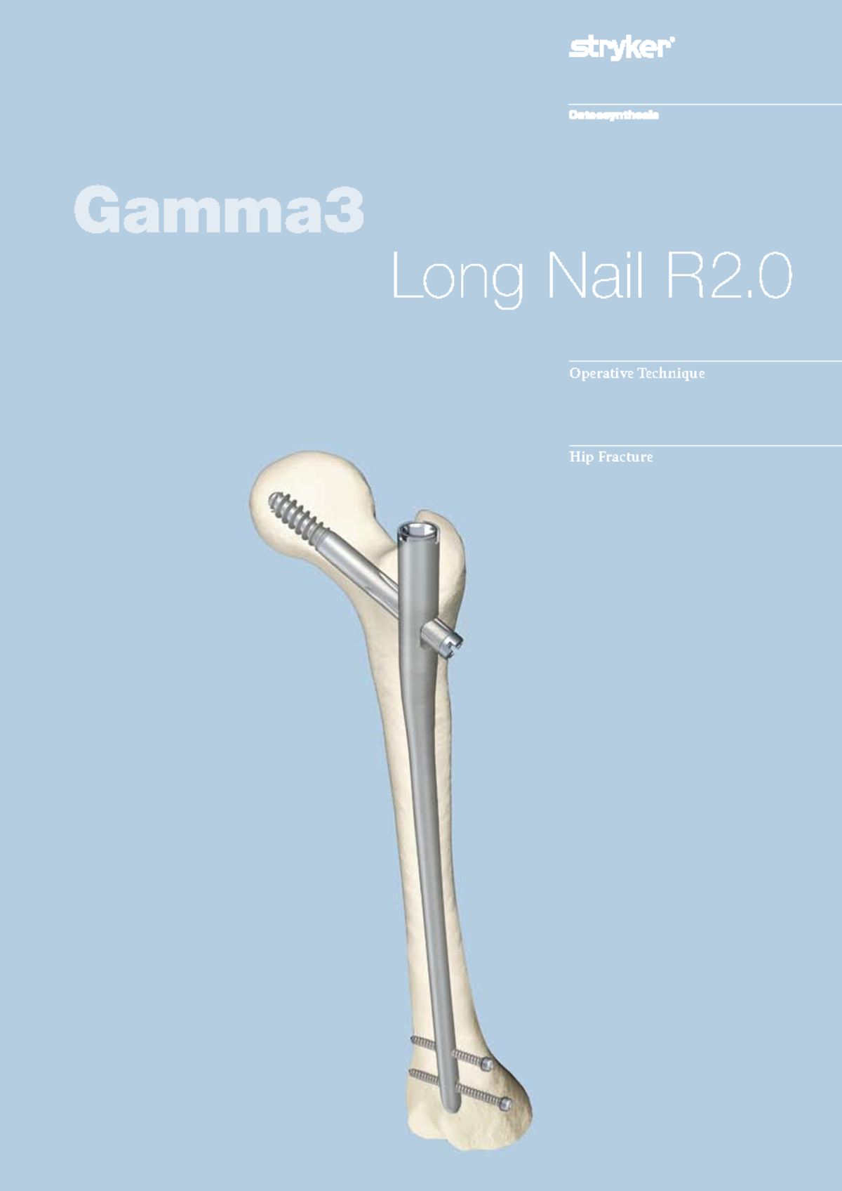 Gamma 3 Long nail (ref B0300009) 1 - Gamma Long Nail R2. Hip Fracture ...