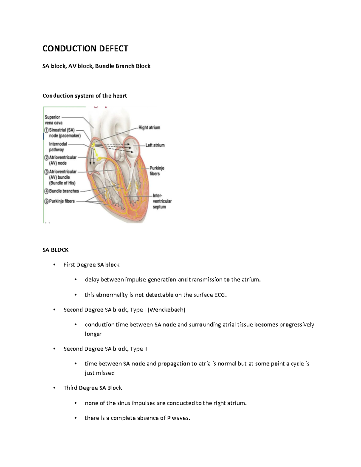 Conduction Defect - Summary Ecgs Made Easy - Ecgs Made Easy ...