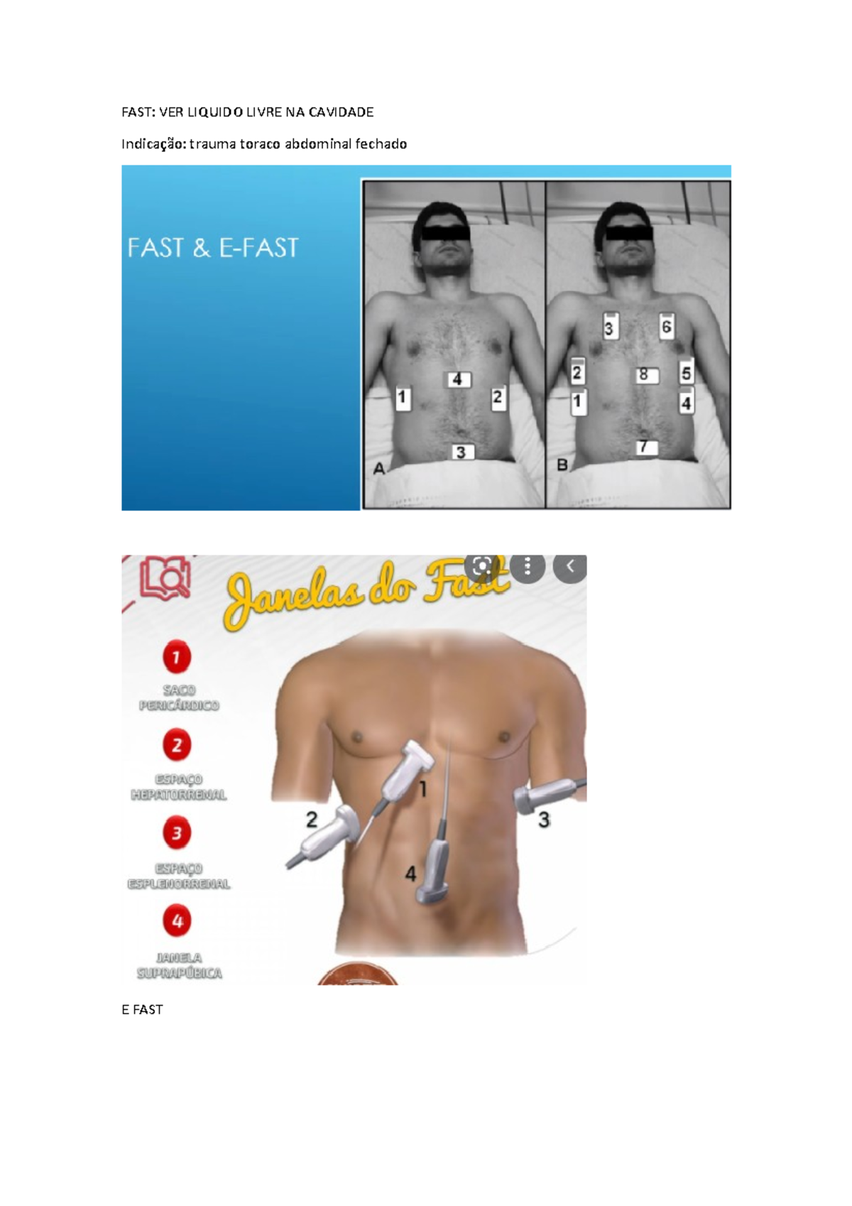 Aula 2- FAST - Prof Jobe Petter - FAST: VER LIQUIDO LIVRE NA CAVIDADE ...