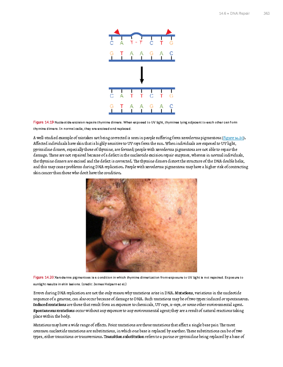 Nucleotide Excision Repair
