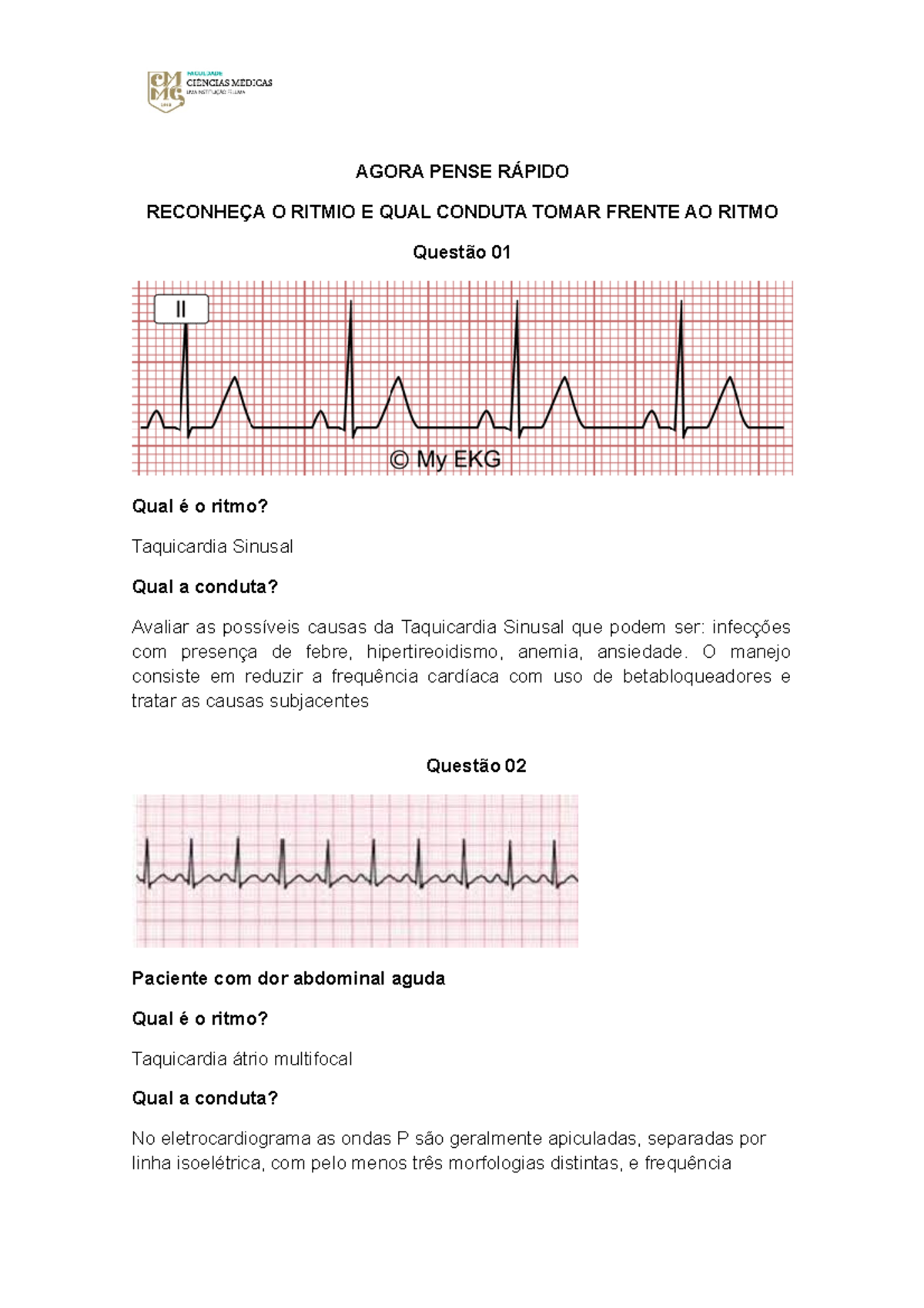 Atividade Ritmos - Análise de ECG. - AGORA PENSE RÁPIDO RECONHEÇA O ...