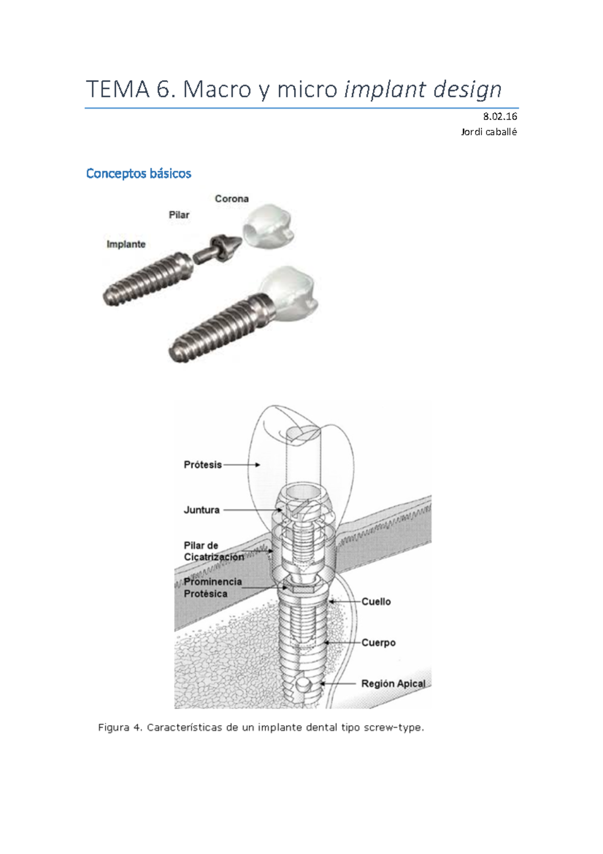 TEMA 6 diseño del implante micro y macro - TEMA 6. Macro y micro implant design 8.02 Jordi ...