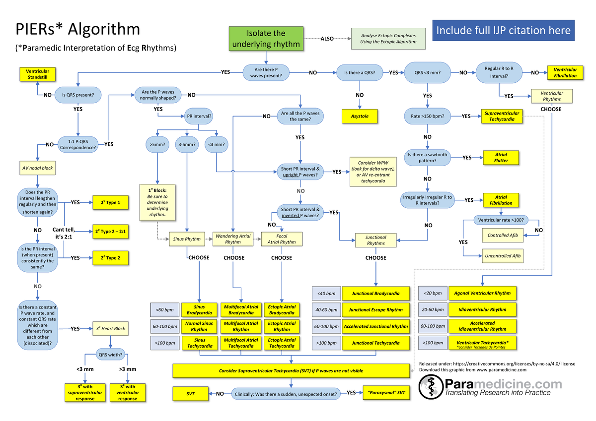 Piers Algorithm full - ECG Help - YES Is QRS present? 1:1 P:QRS NO ...