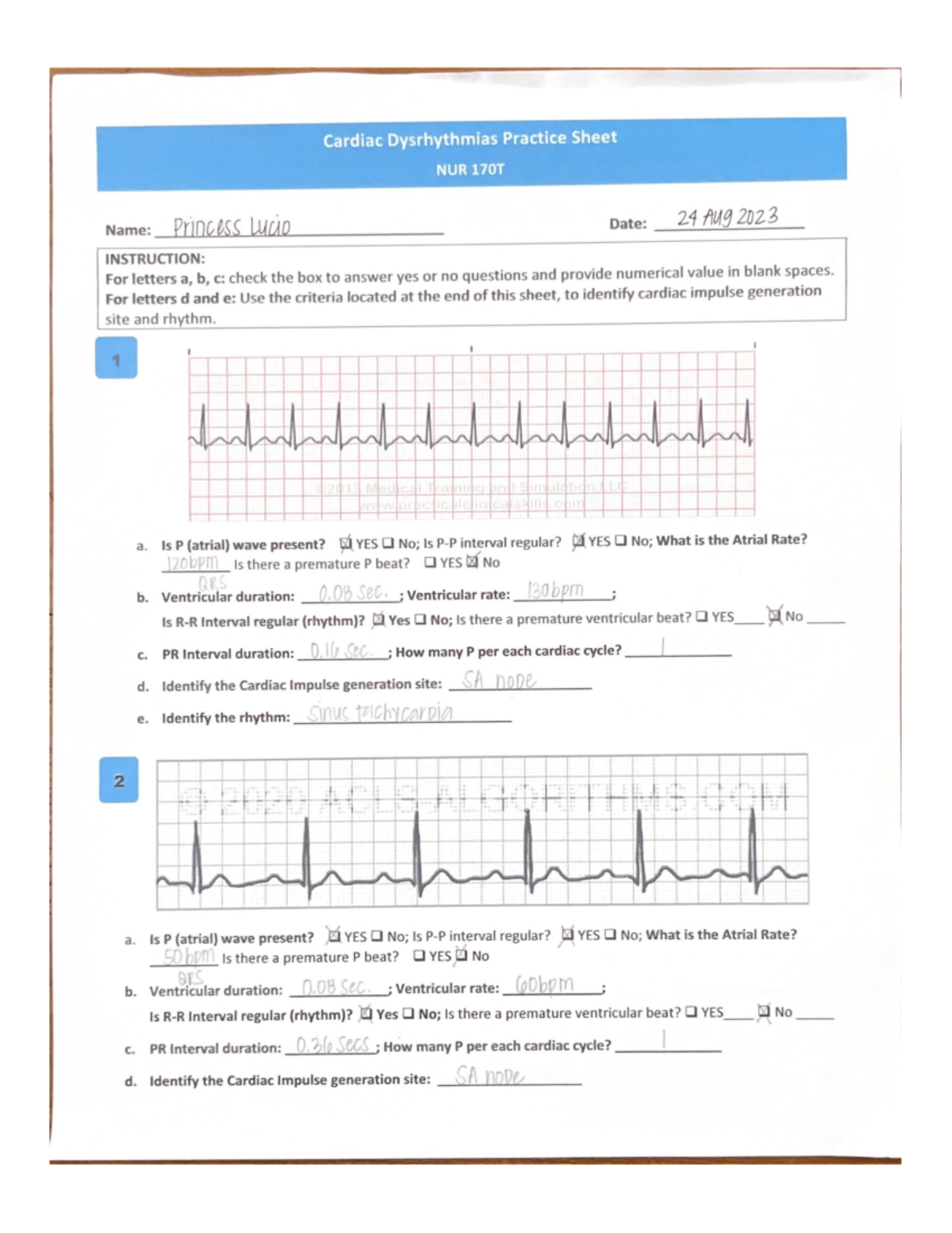 EKG Homework MSMU - Studocu