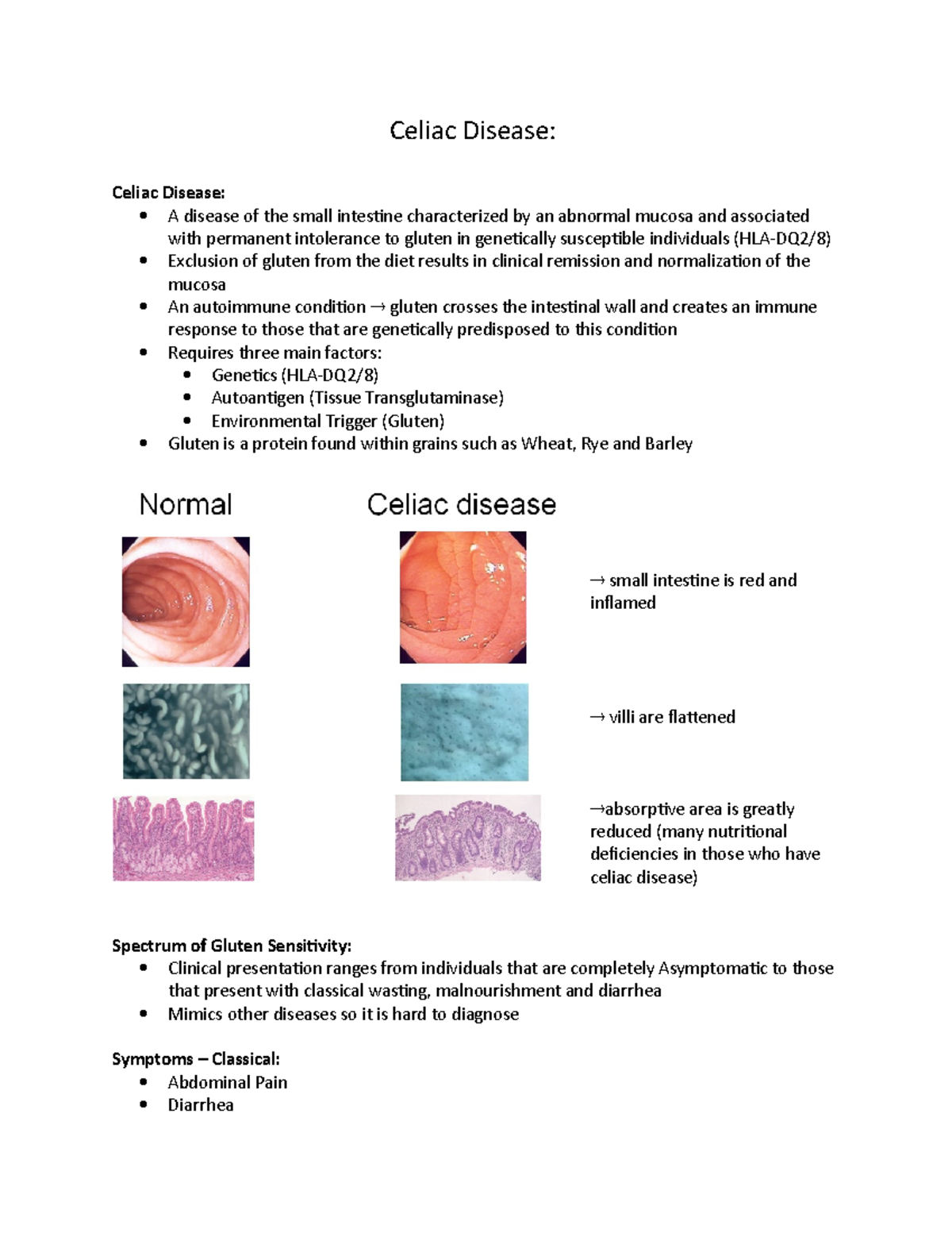 Celiac Disease-2 - Lecture Notes - Celiac Disease: Celiac Disease: A ...