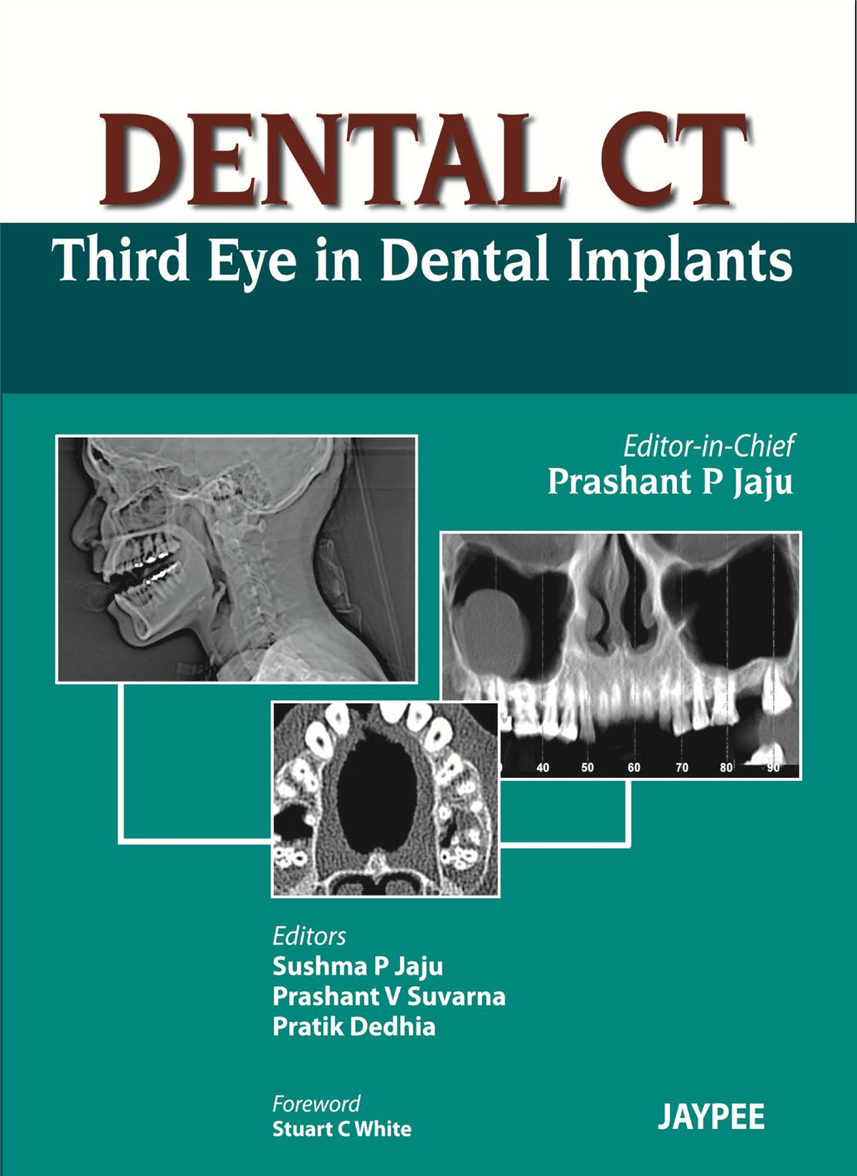 Dental CT Third Eye in Dental Implants ( PDFDrive ) - DENTAL CT THIRD EYE IN DENTAL IMPLANTS ...