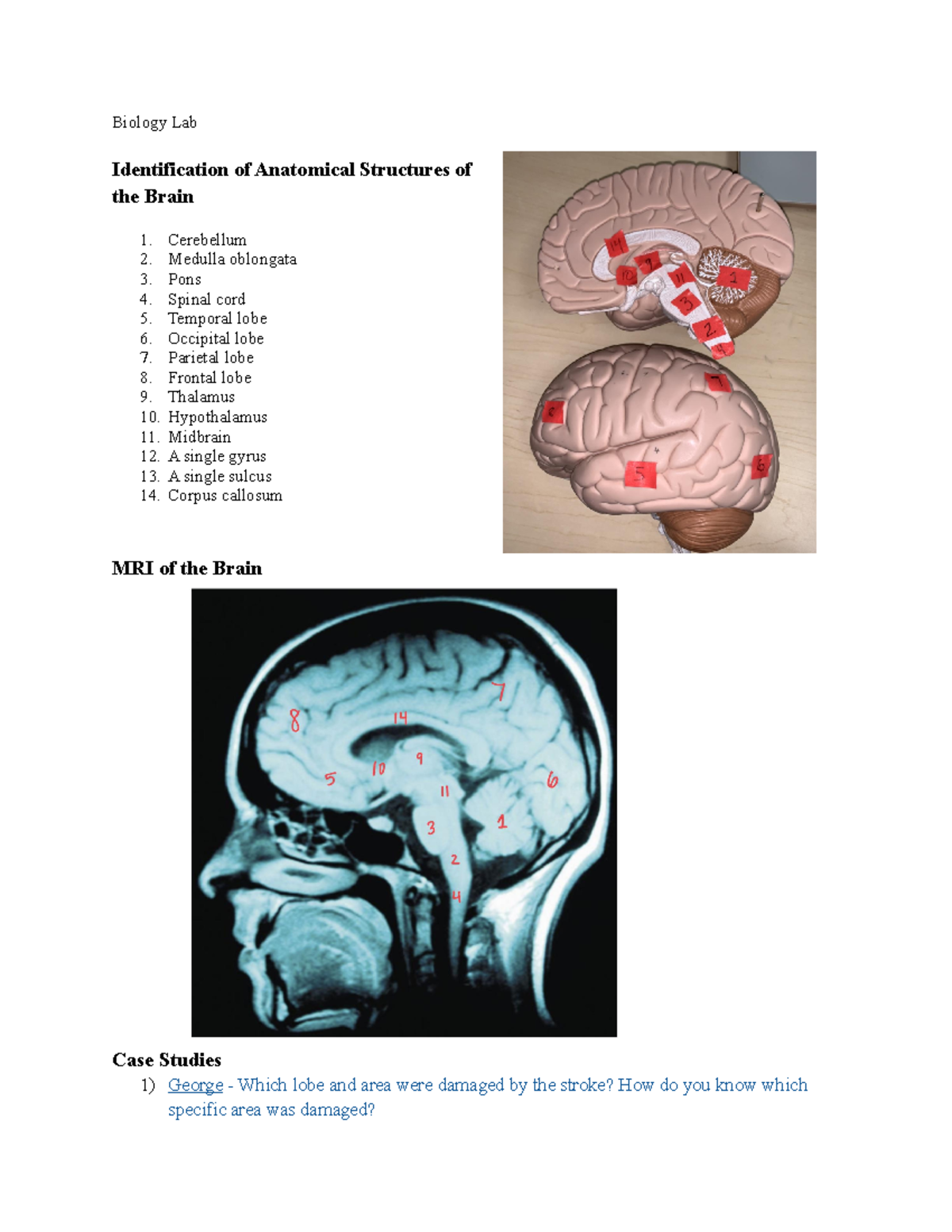CNS Lab - CNS Lab - Biology Lab Identification of Anatomical Structures ...