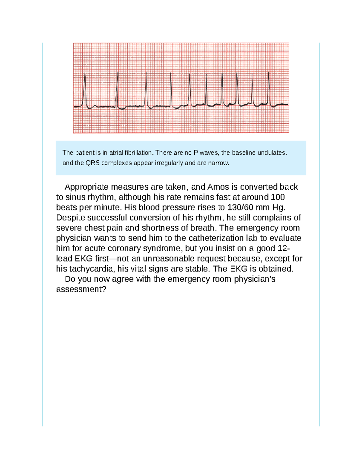 The only EKG-109 - The only EKG - The patient is in atrial fibrillation ...
