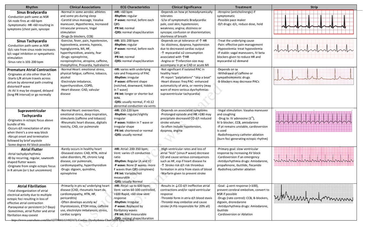 Cardiac Dysrhythmia Chart Med Surg Nur4 - Rhythm Clinical Associations ...