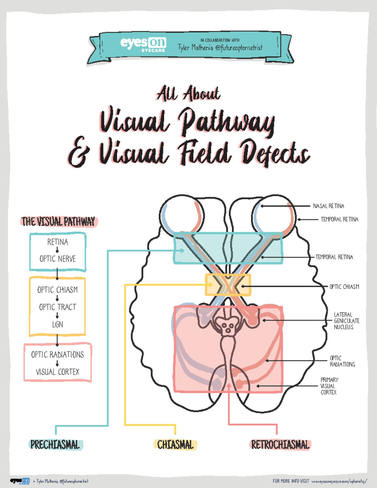 Visual Pathway and Visual Field Defects Study-Guide - THE VISUAL ...
