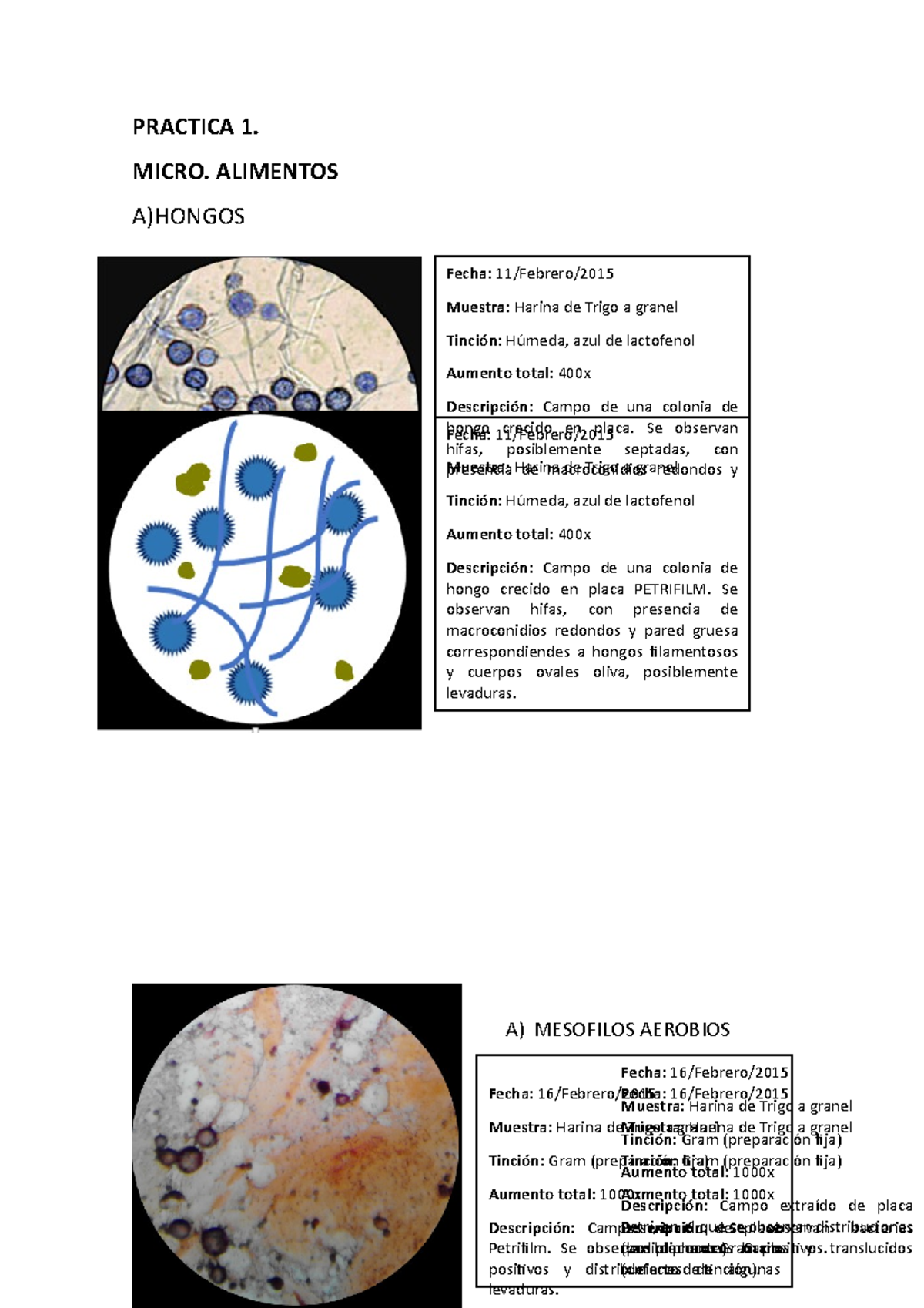 Practica 1 - Microbiología - PRACTICA 1. MICRO. ALIMENTOS A)HONGOS A ...