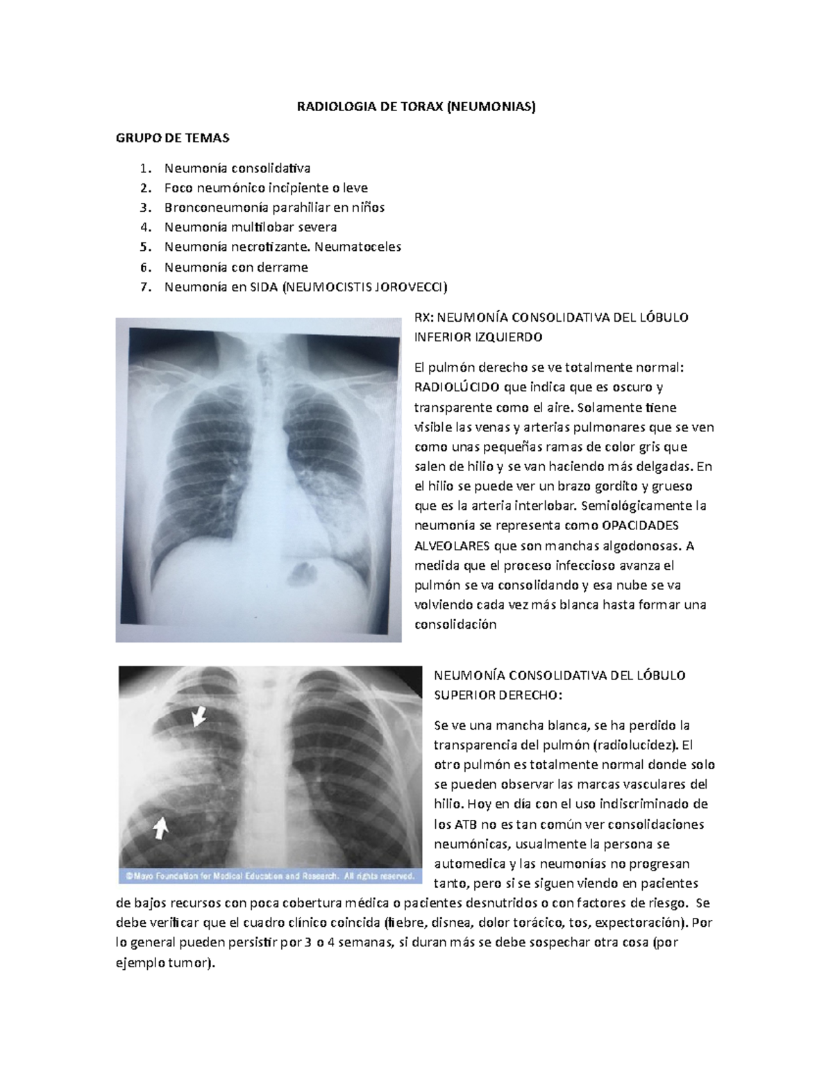 Primera Semana Parada - RADIOLOGIA DE TORAX - RADIOLOGIA DE TORAX ...