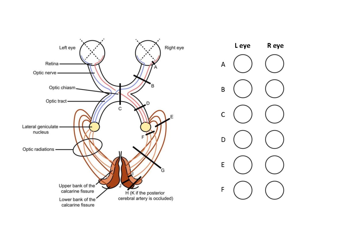 Wk 11 Visual Field Deficits Blank - CHI 336 - Left eye Right eye L eye ...