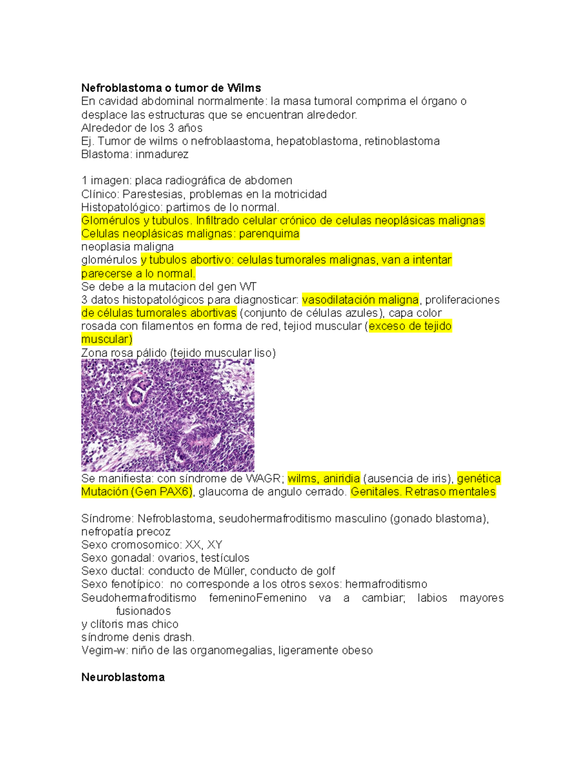 Laboratorio parcial 2 - Nefroblastoma o tumor de Wilms En cavidad ...