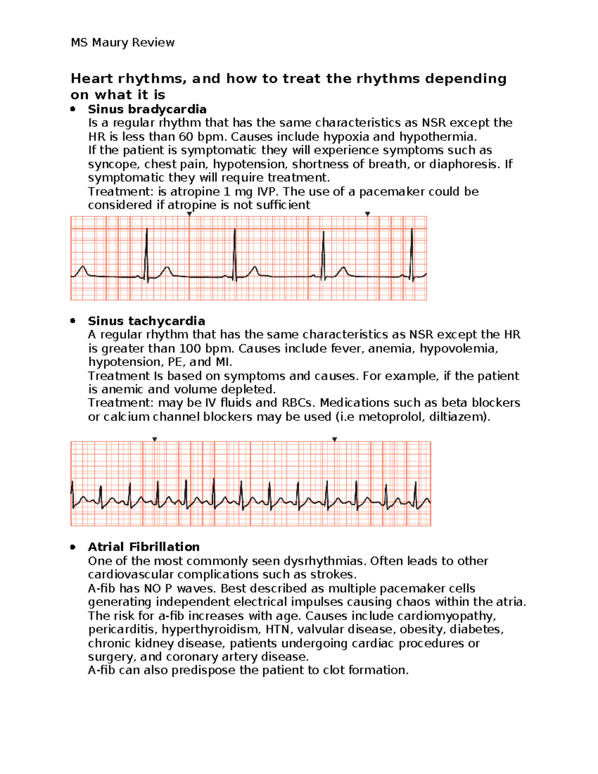 Exam I rhythyms - Rhythms - Heart rhythms, and how to treat the rhythms ...