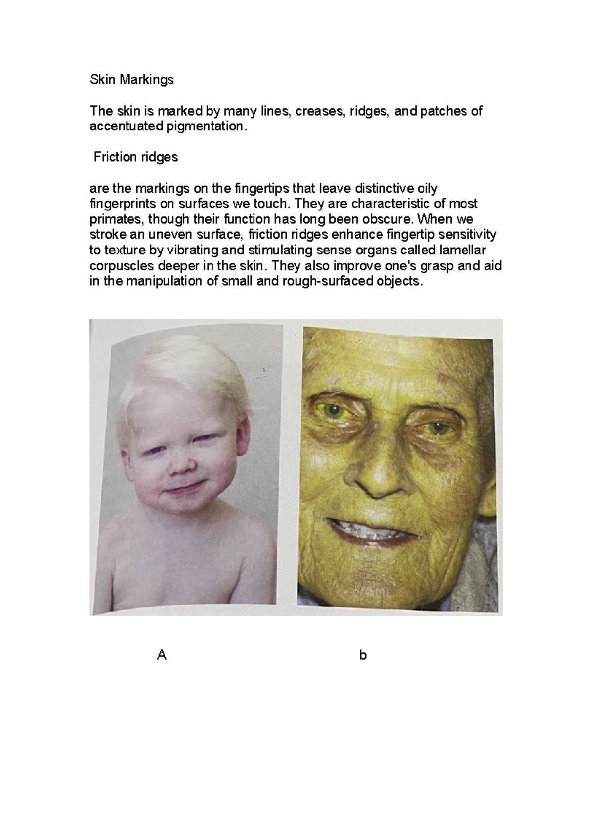 Skin Markings - Skin Markings The skin is marked by many lines, creases ...