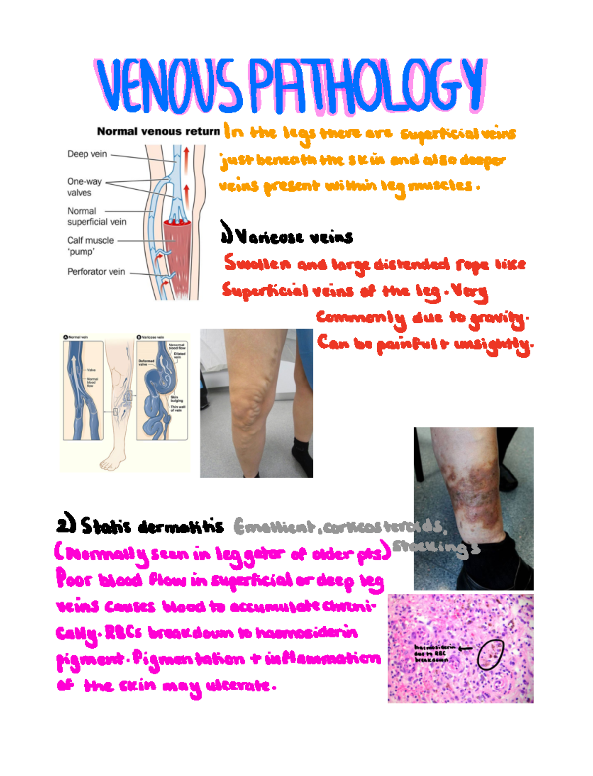 Pathology of venous circulation - VENOUS PATHOLOGY In the legs there ...