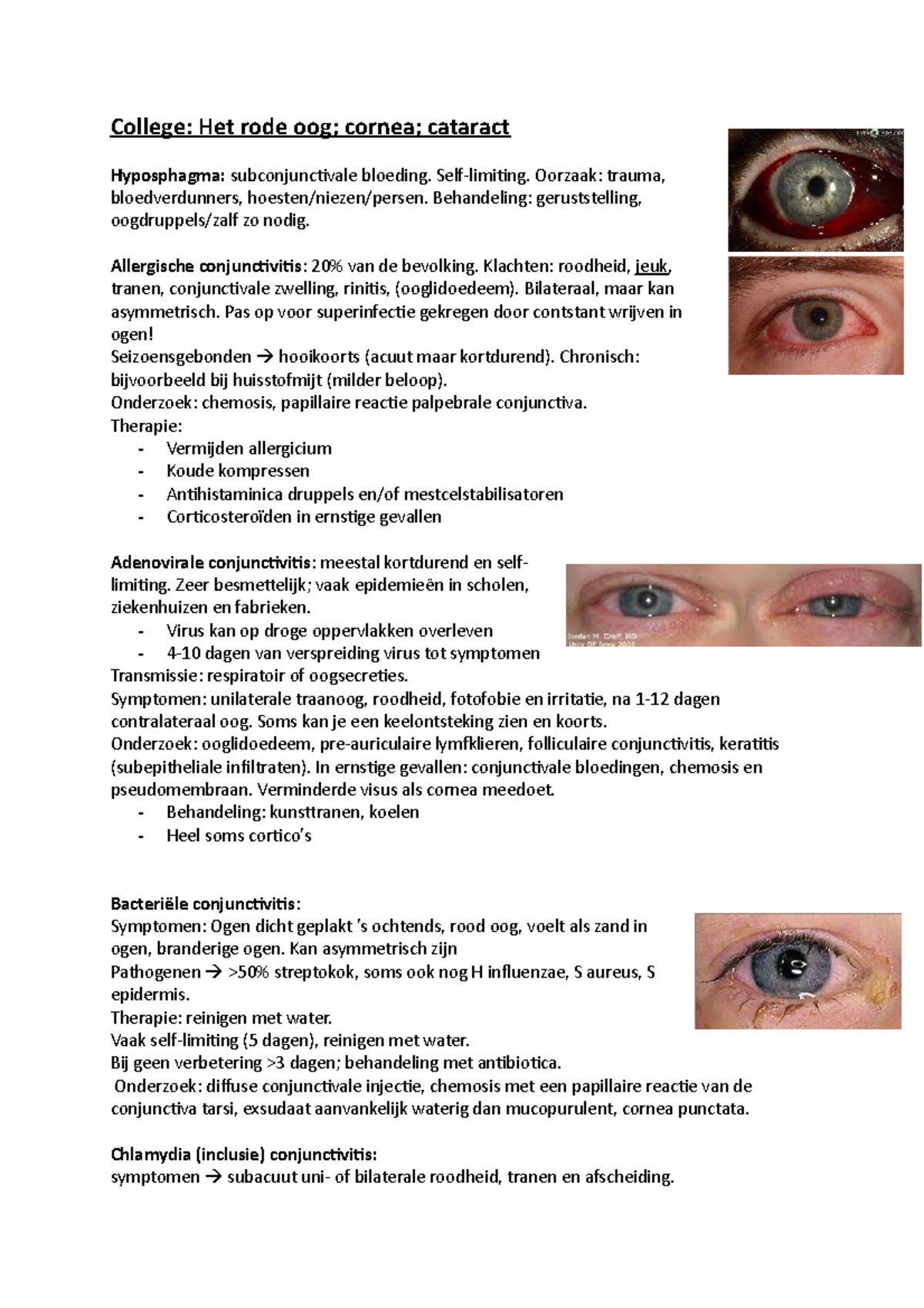 Het rode oog en cataract - College: Het rode oog; cornea; cataract ...