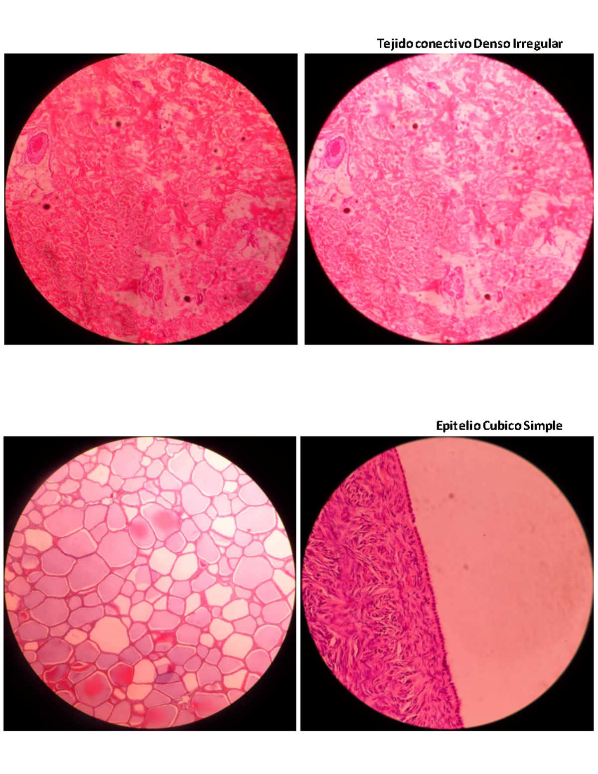 Fotos de histologia 1 - Tejido conectivo Denso Irregular Epitelio ...