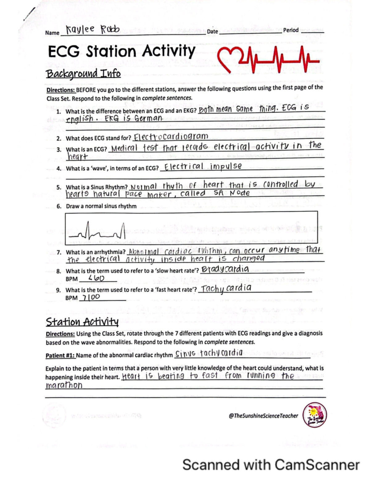 EKG Worksheet - Name kaylee Robb Date Period ECG Station Activity ...