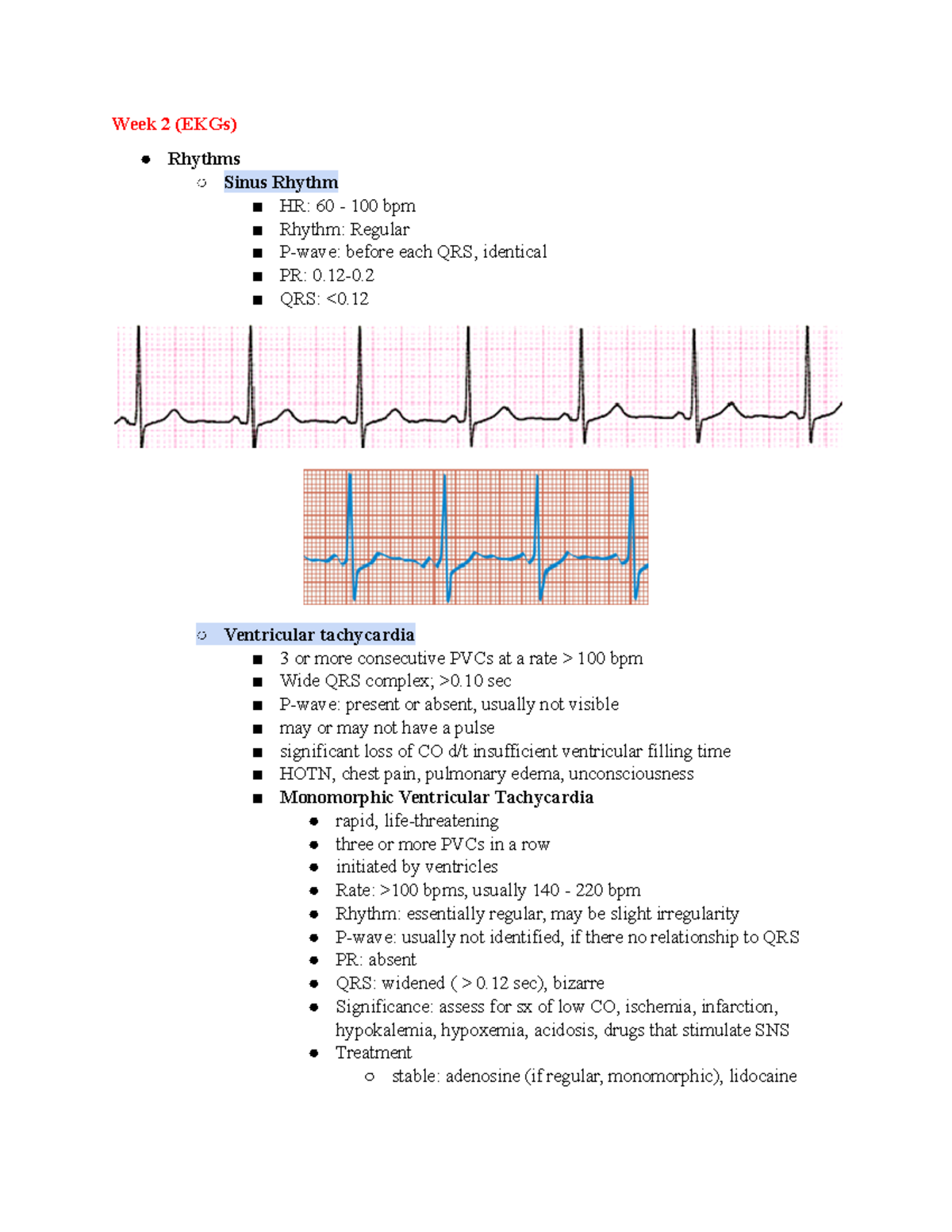 NSG 472 Exam 1 Study Guide - Week 2 (EKGs) Rhythms Sinus Rhythm HR: 60 - 100 bpm Rhythm: - Studocu