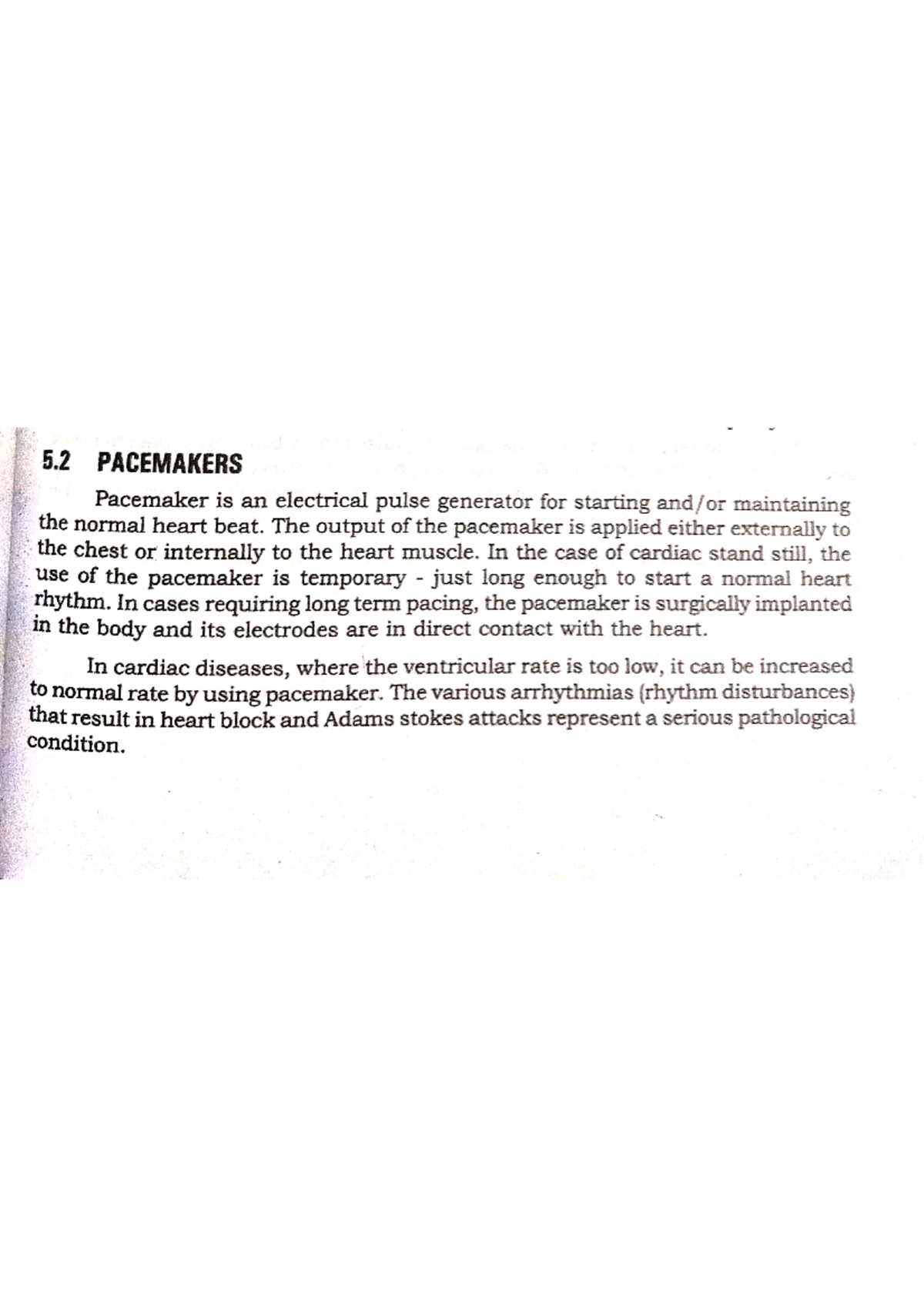 Pacemaker-Medical Electronics - Medical Electronics - Studocu