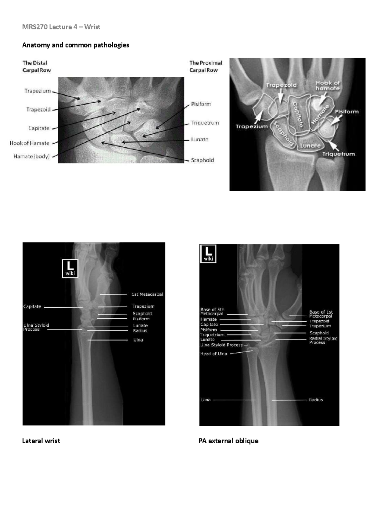 MRS270 Lecture 4 - Wrist - MRS270 Lecture 4 – Wrist Anatomy and common ...