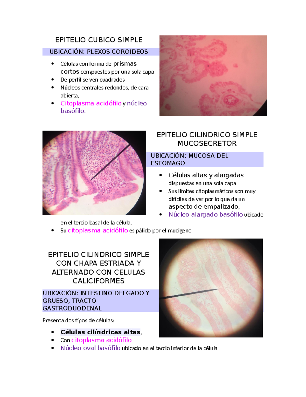 Histo logiaaaa - Descripciones - EPITELIO CUBICO SIMPLE UBICACIÓN: PLEXOS COROIDEOS Células con ...