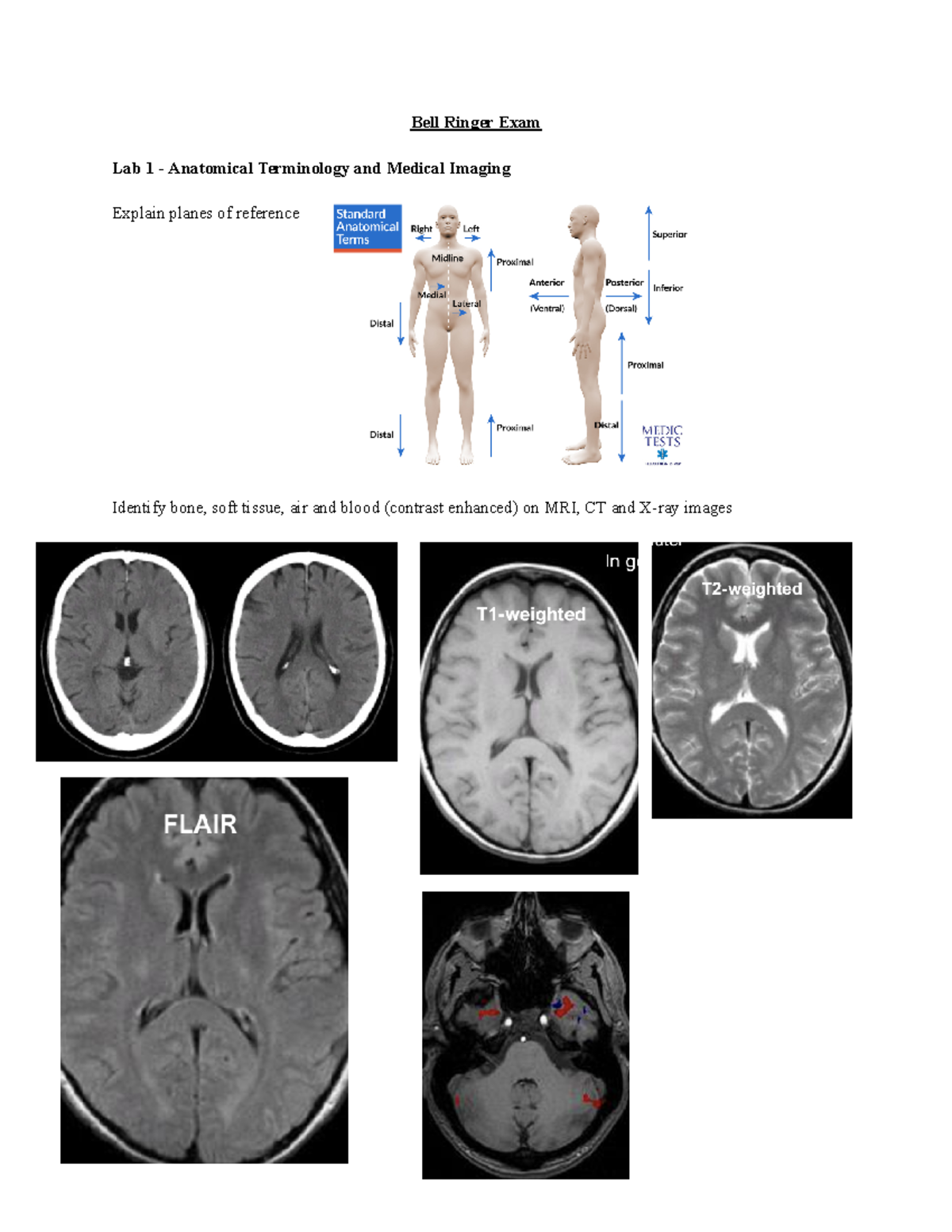 bell ringer practice - Bell Ringer Exam Lab 1 - Anatomical Terminology ...