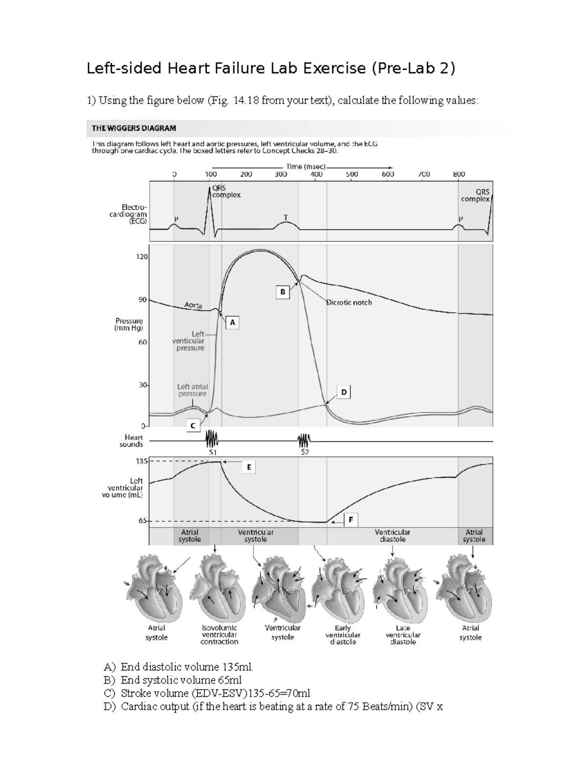 Cardiovascular Prelab part 2 - Left-sided Heart Failure Lab Exercise ...