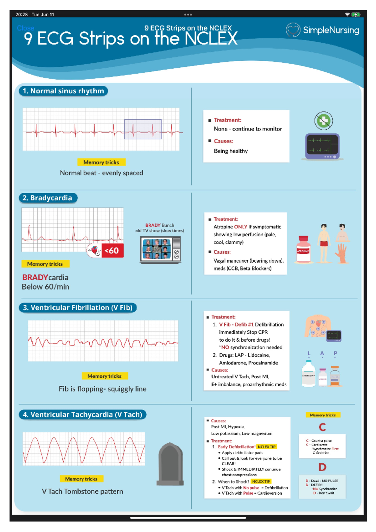 ECG Strips - Normal sinus rhythm Treatment: None continue to monitor ...