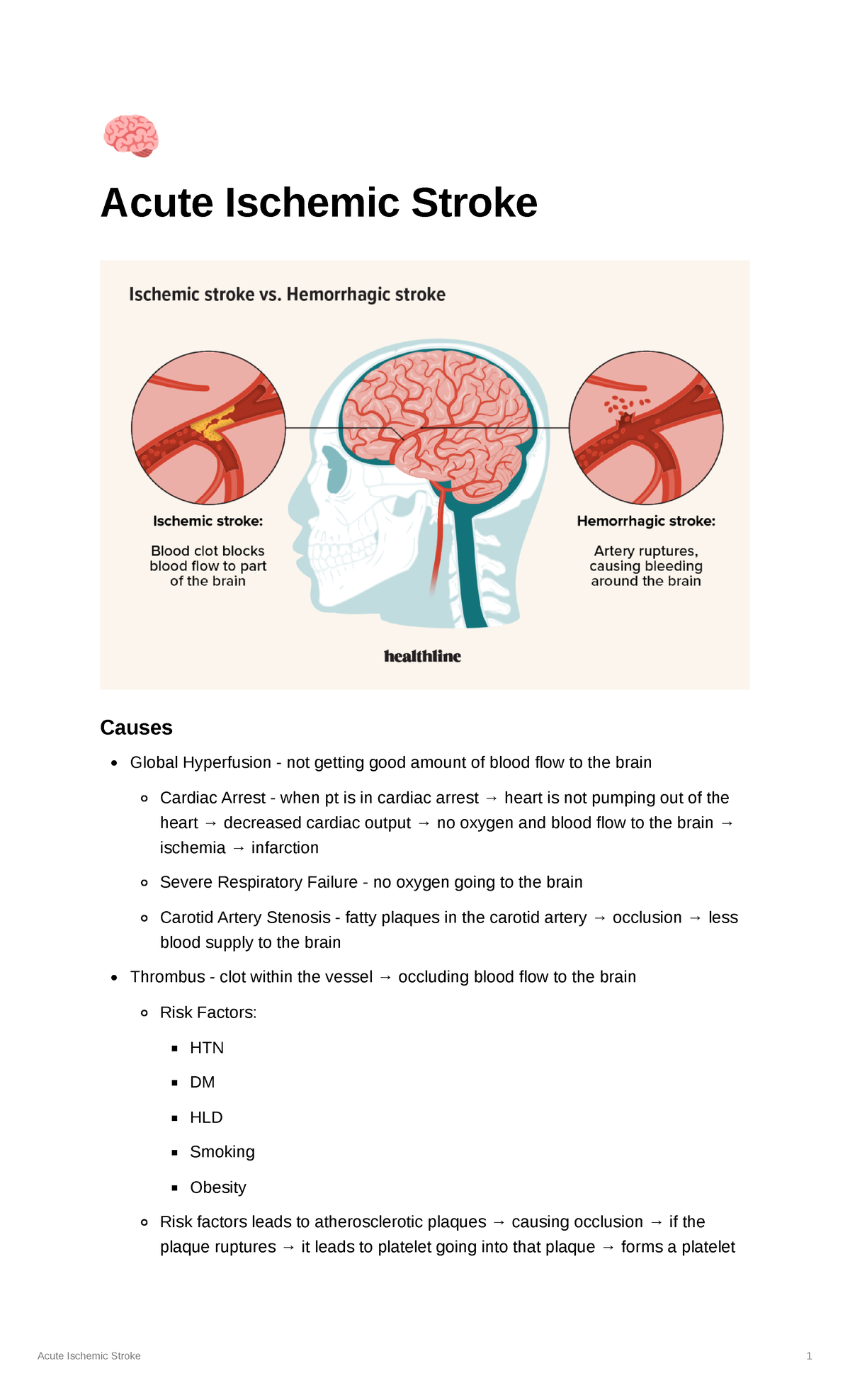 Acute Ischemic Stroke 4c1a1589f30040 ee824b84b9b86cacb2 - Acute ...
