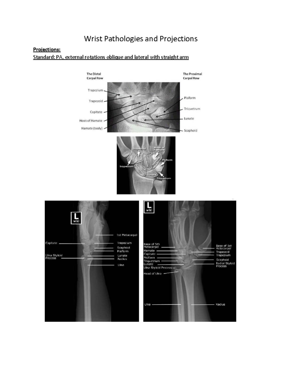 Wrist - Table Summaries of each pathology - Wrist Pathologies and ...