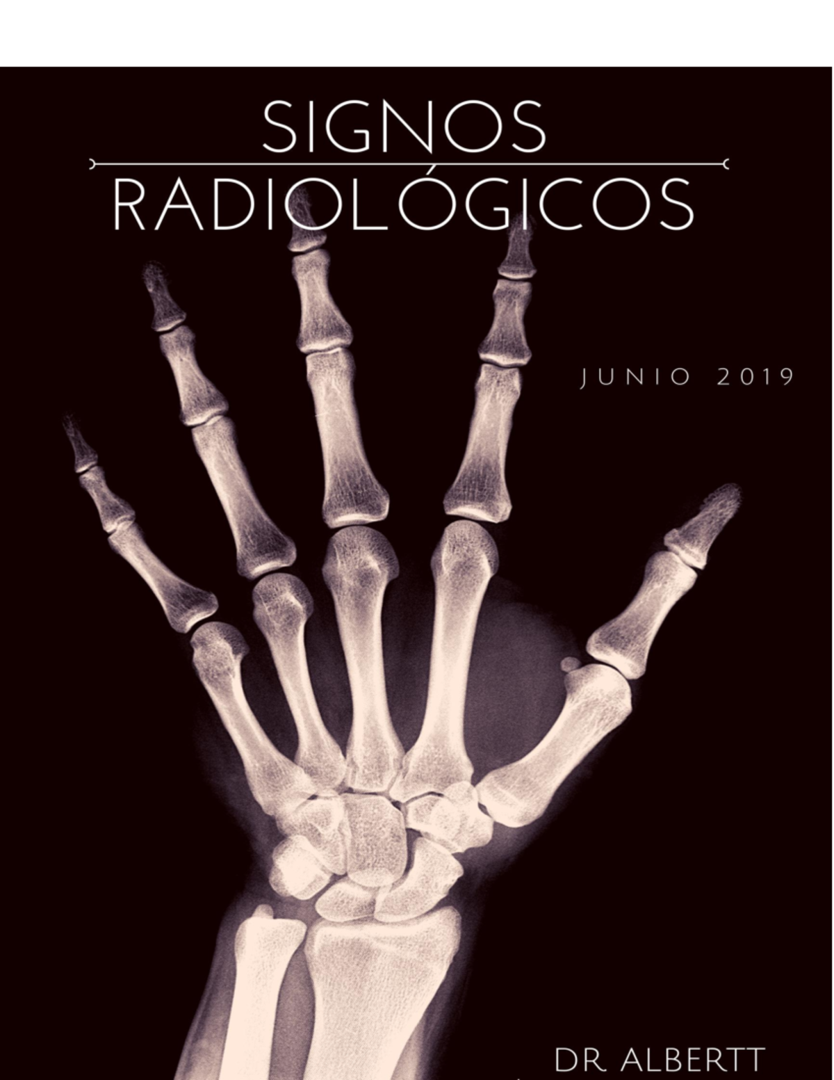 Signos Radiologicos by Dr. Albertt - RESUMEN El signo de la arteria ...